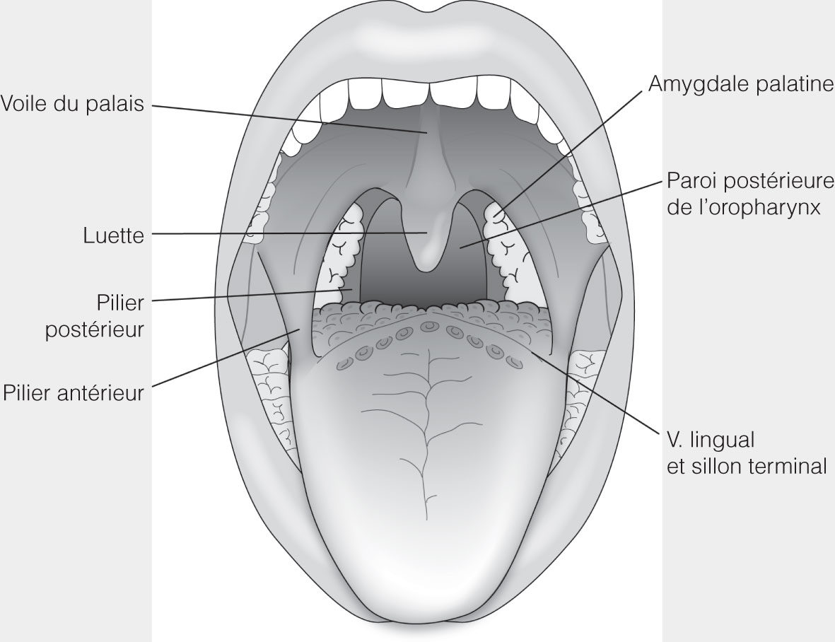 Chirurgie ORL Tahiti